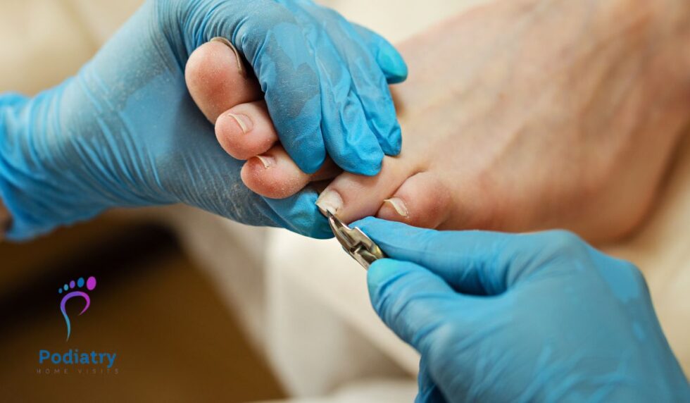 How To Cut Your Toenails Correctly – A Podiatrist’s Guide | Podiatry ...